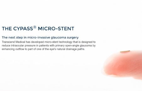 Fraser Eye Care Blog - LASIK, Cataract, Laser Vision Correction